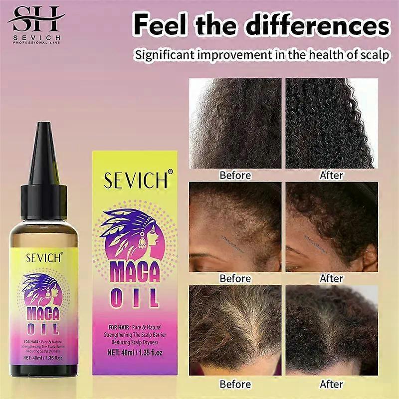 Maca Hair Growth Oil Set For Peru Maca Powder Hair Growth Butter Maca ...