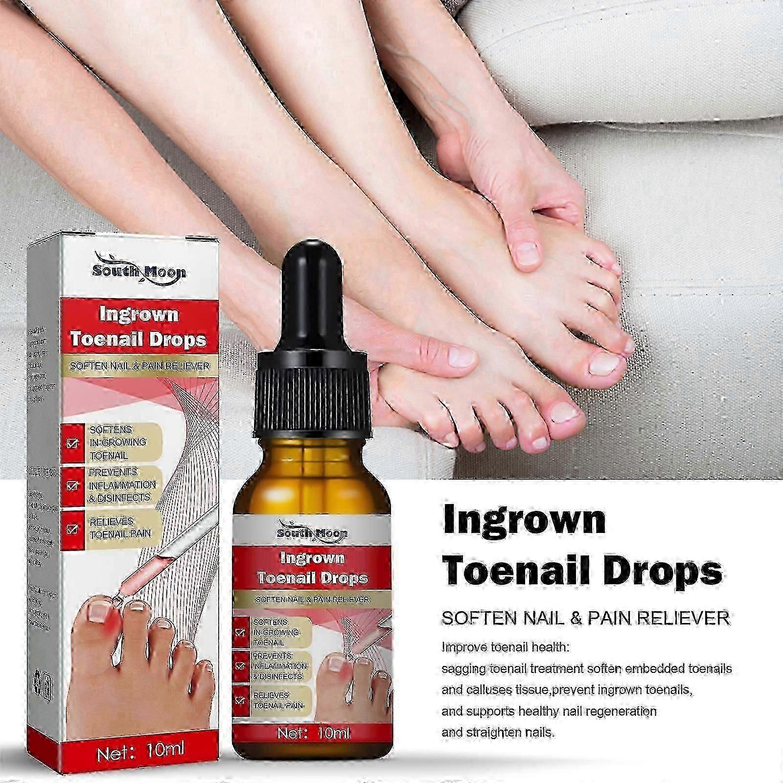 30ml Ingrown Toenail Treatment,nail Treatment,ingrown Toenail Drops ...