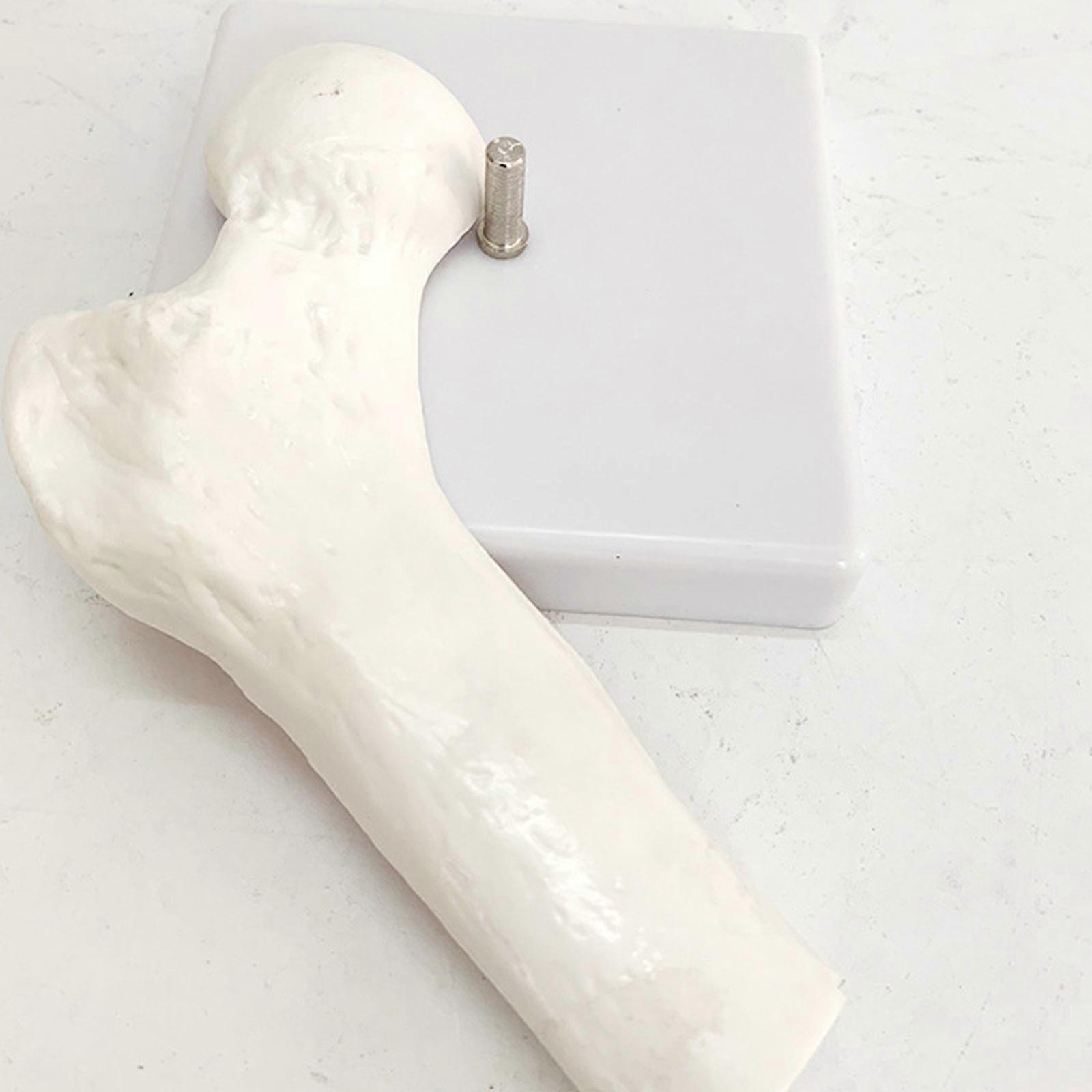 Human Femur Leg Bone Model Medical Anatomy Skeleton Model Osteoporosis ...