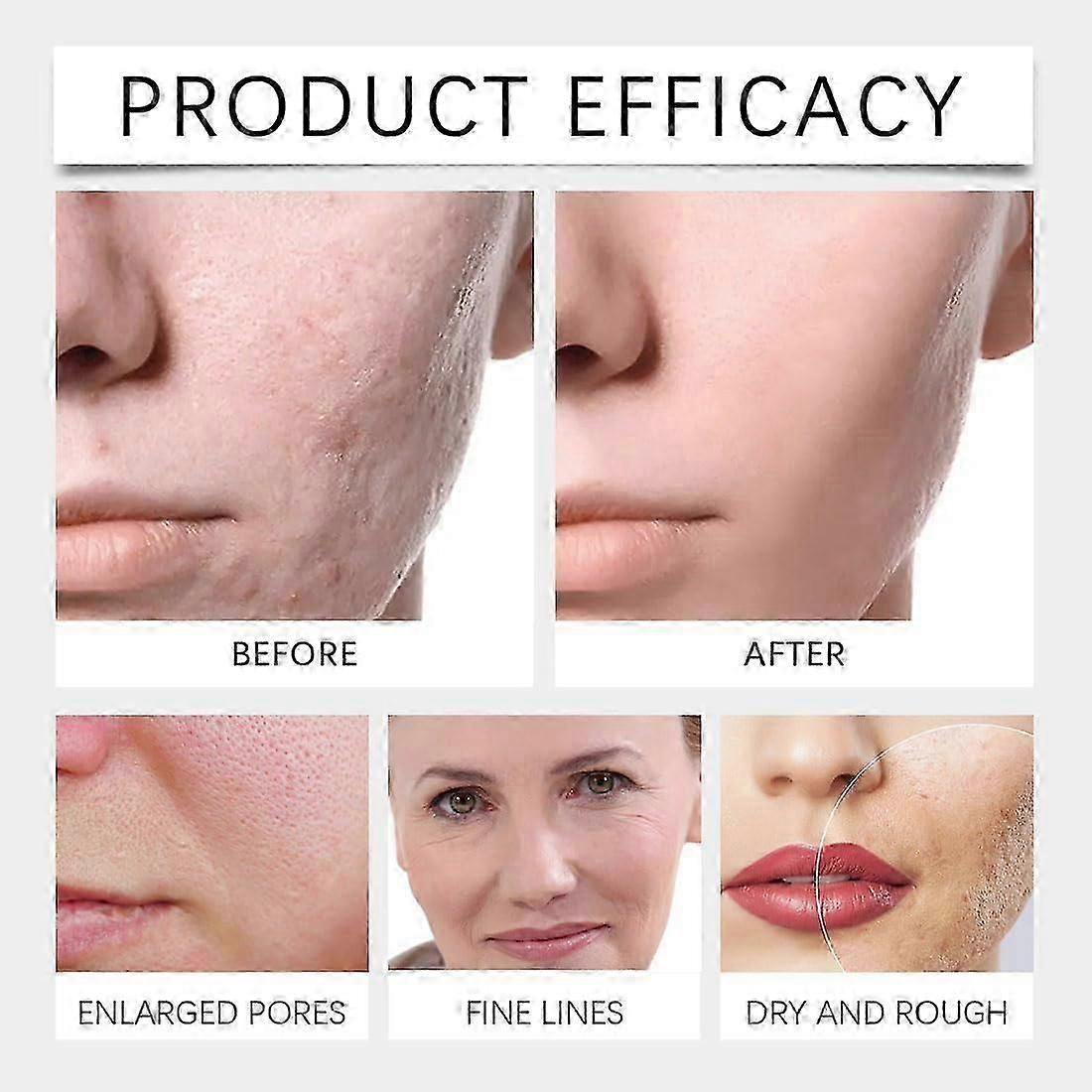 Ss Collagen Reverse Volume Peel Off Face Mask Pack, Collagen Face Mask ...