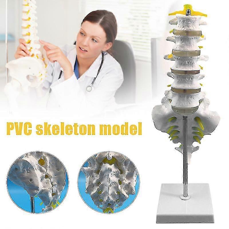 Life Size Lumbar Spine Model Lumbar Vertebral Spine Anatomy Model For ...