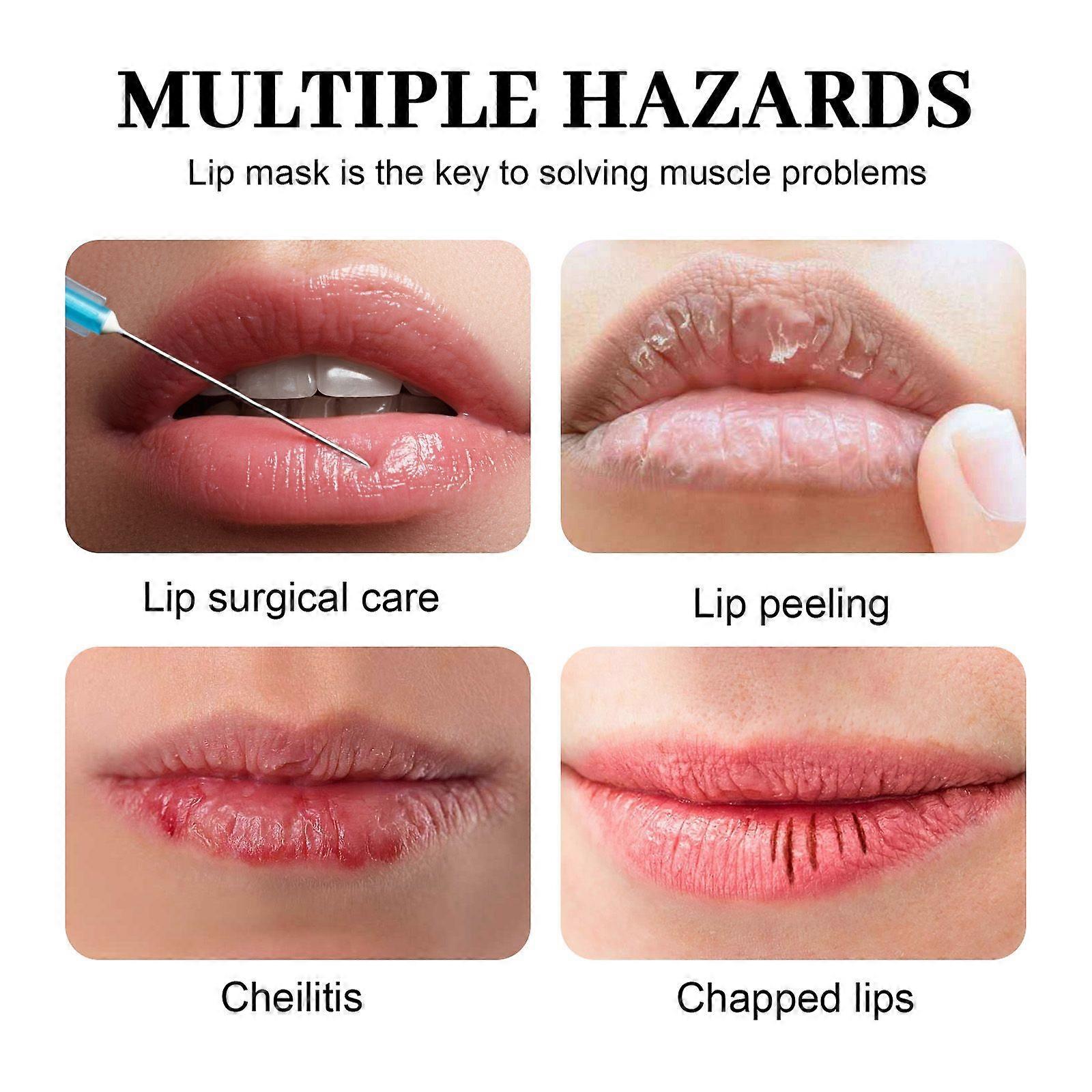 Marine Collagen Lip Mask, Moisturizing Moisturizing Light Lip Lines ...