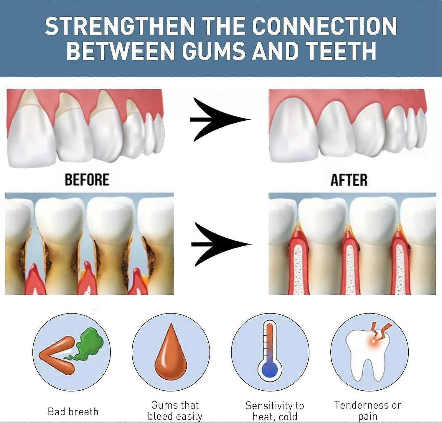 1-3X Gum Restore Plus - Oral Drops For Teeth, Bad Breath, Gums Repair ...