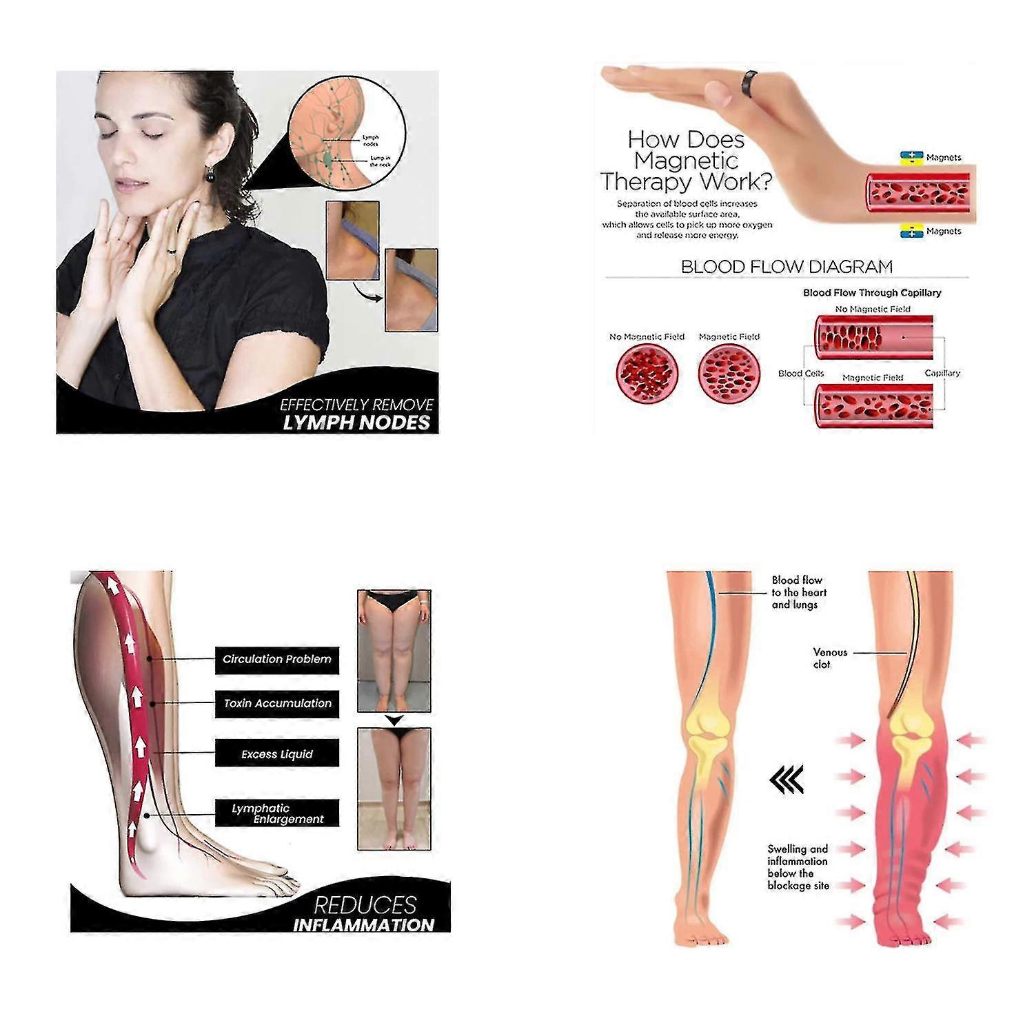 Magnetic Ring Lymphatic Drainage Therapy Magnetic Ring | Fruugo UK