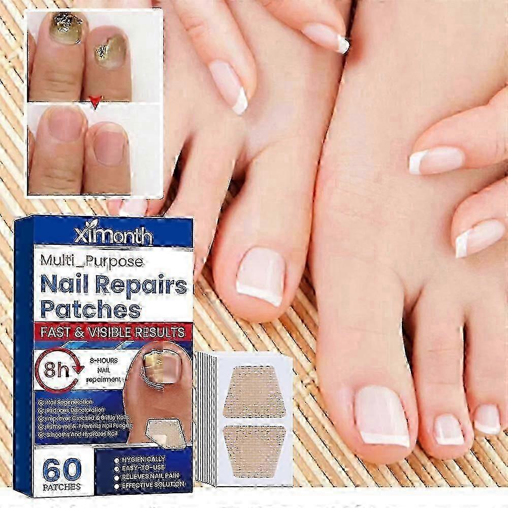 60-180pcs Toenail Fungus Treatment Stickers Ingrowning Toenail Nail ...