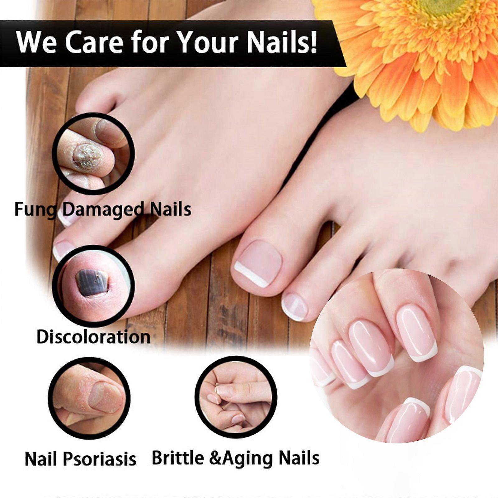 Nail Repair Solution Thickening And Brightening Nails Removing Gray ...