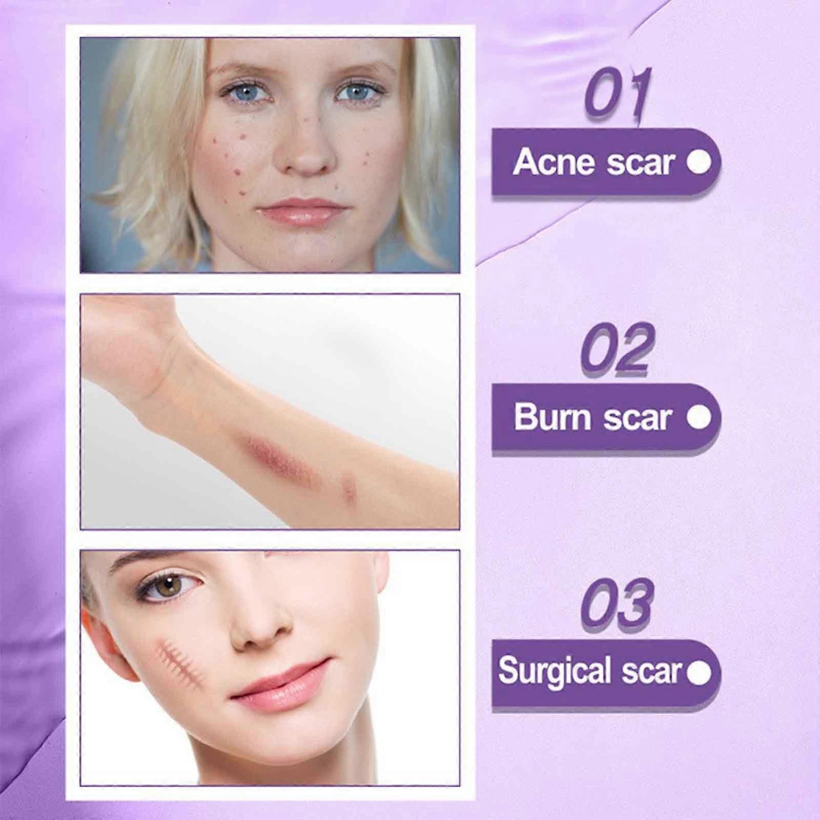 Scar Repair Seaweed Extract Oil Antiscar Repair Cells Shiny Smooths ...