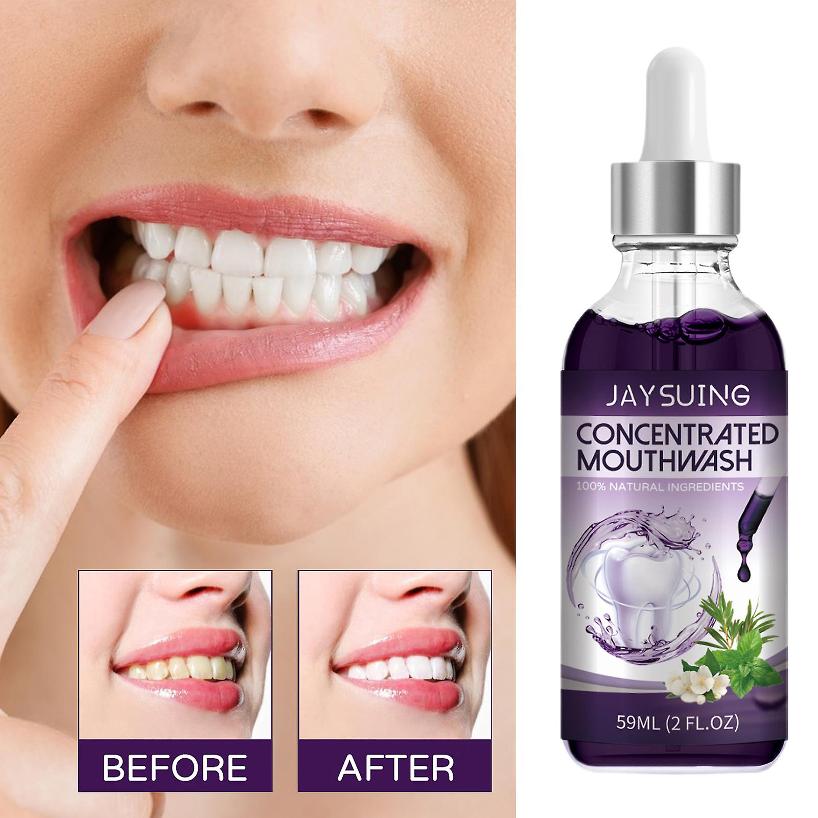 59ml Mouthwash Natural Ingredients Stain Remover Reduce Bad Breath Anti ...