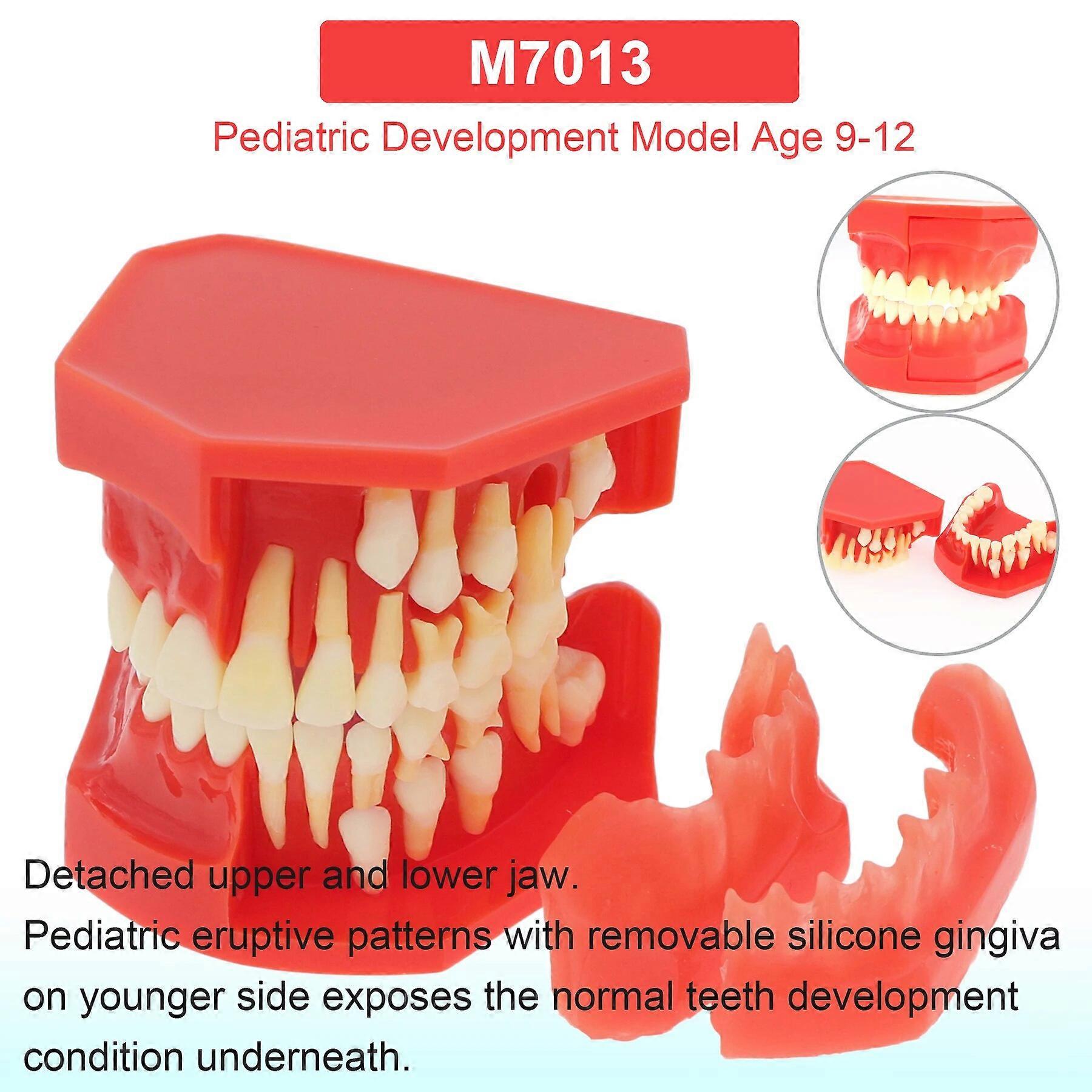 Dental Teeth Model Dental Teaching Models Implant Model Removable ...