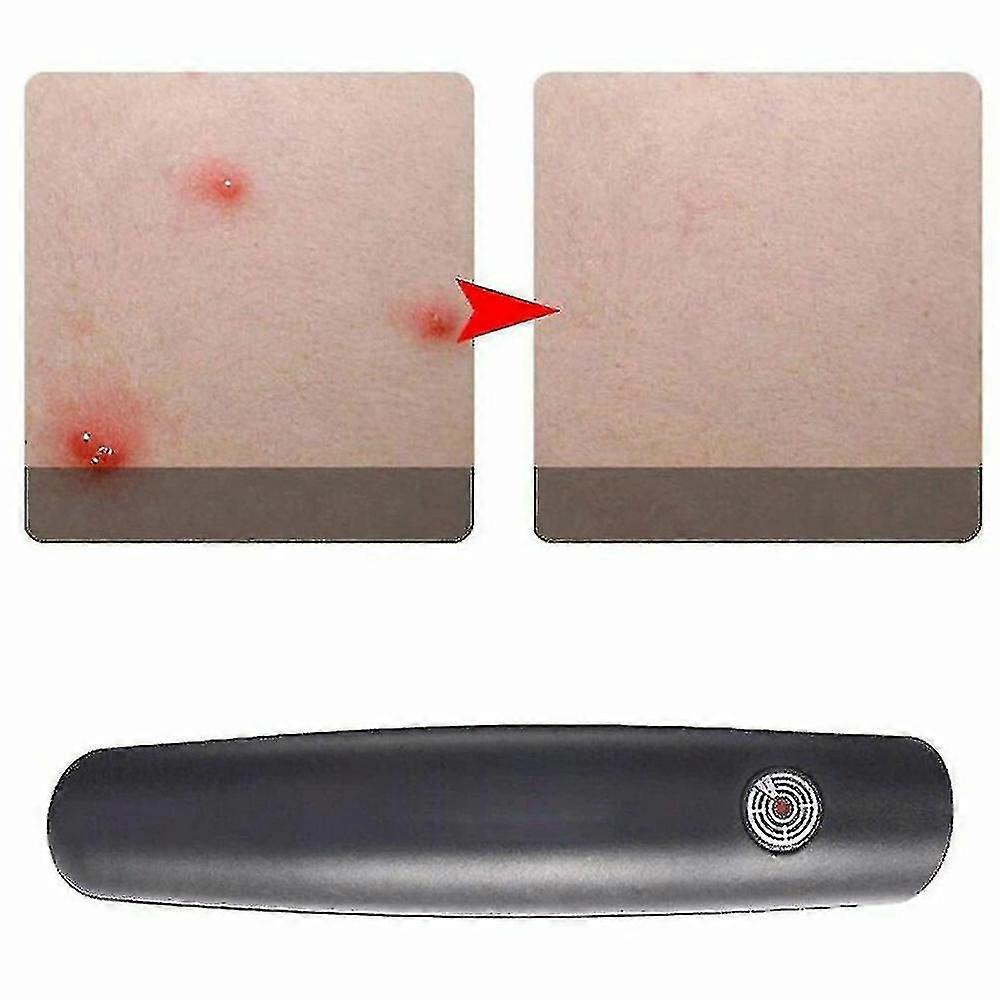 Portable Bug Pen Relieve Bite Helper Mosquito Insect Bites Stings ...