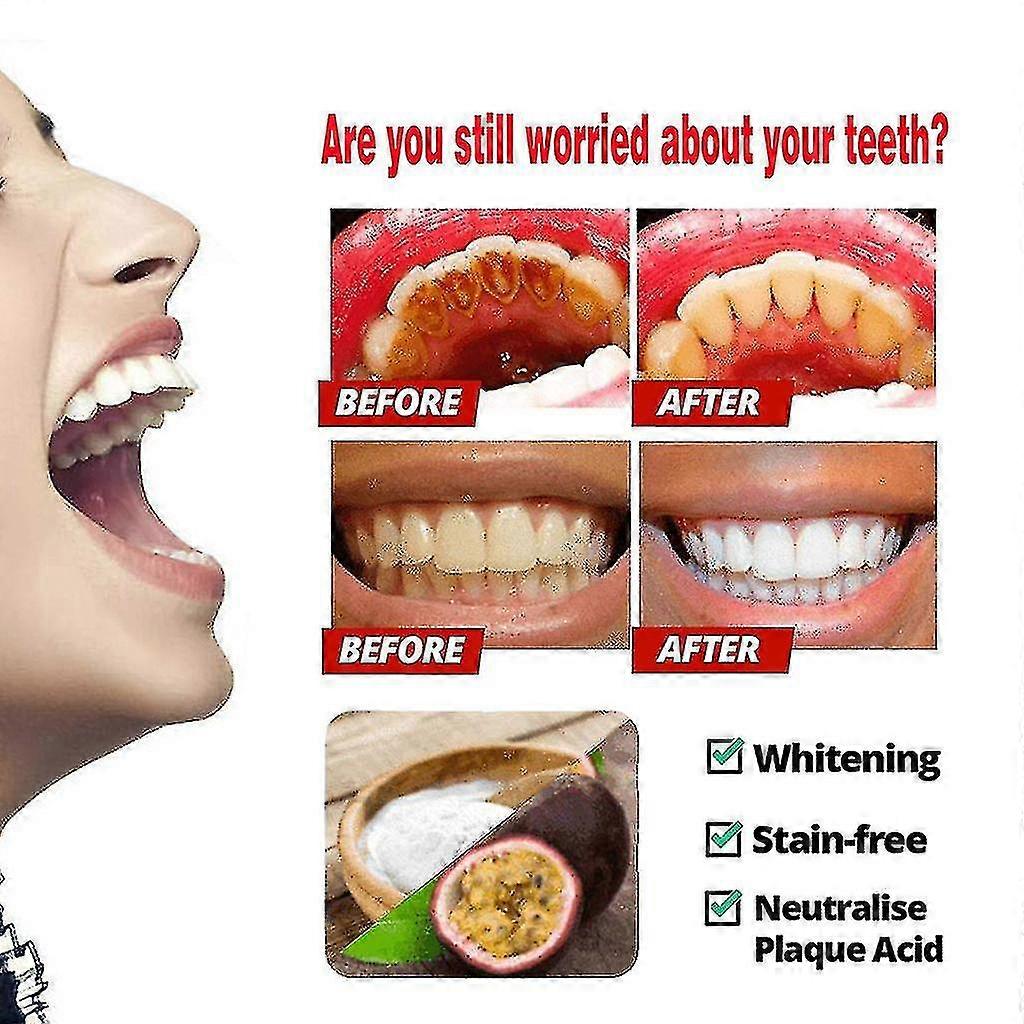 Stain Removal Whitening Toothpaste Fight Bleeding Gums Toothpaste 200ml ...