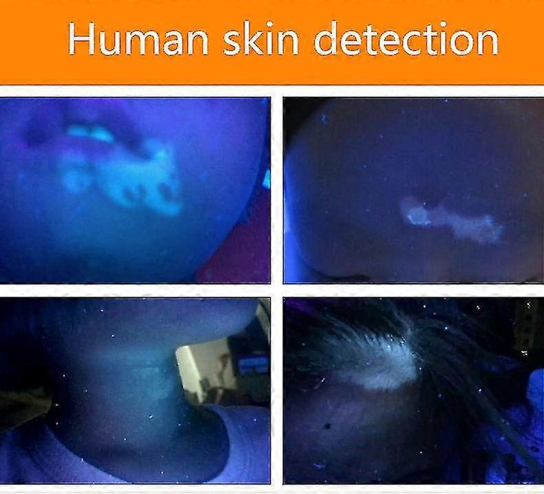 Lightweight Hand-held Wood's Lamp Wavelength Ultraviolet Diagnostic Uv ...