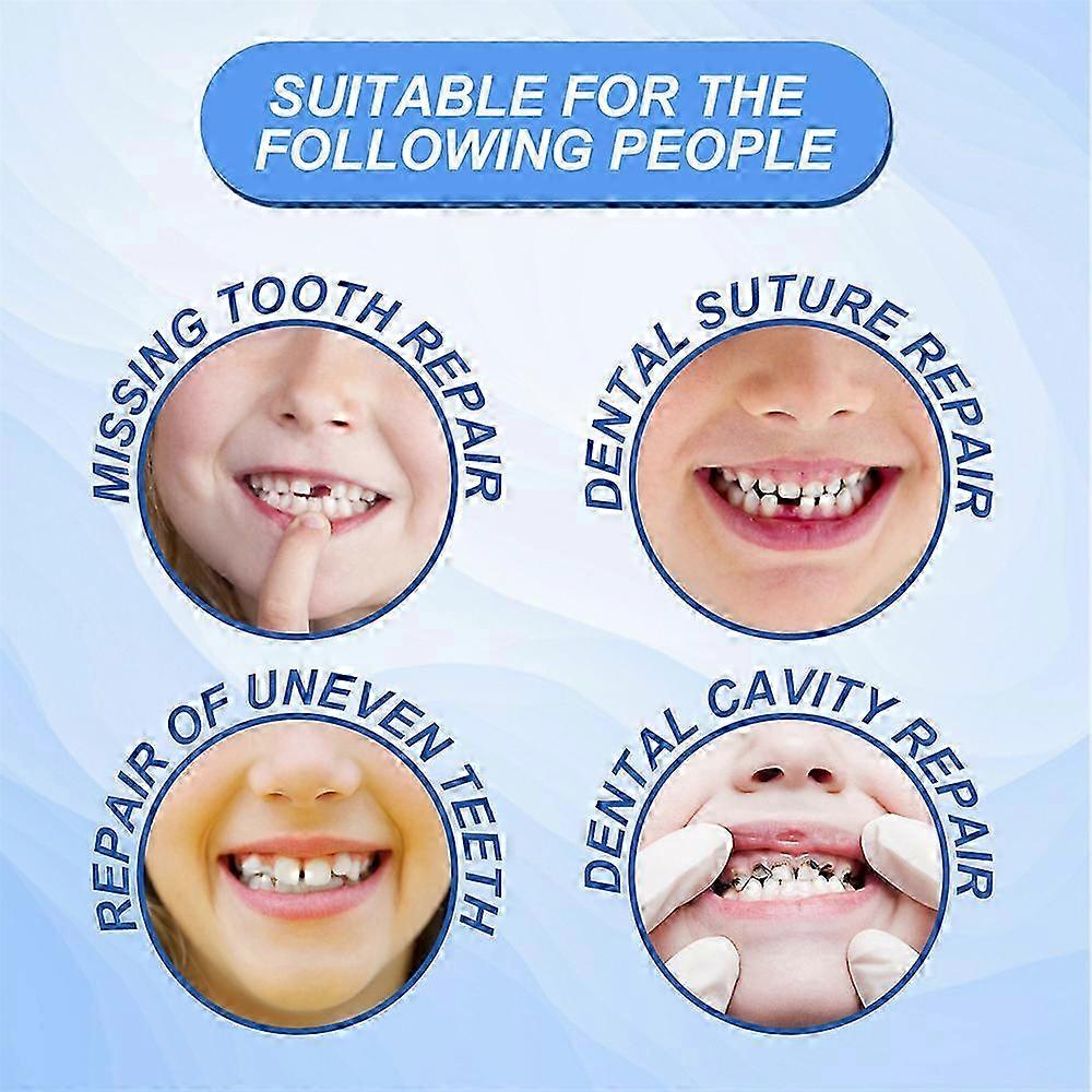Resin Tooth Repair Glue Shapeable Teeth Gaps Filling Solid Glue ...
