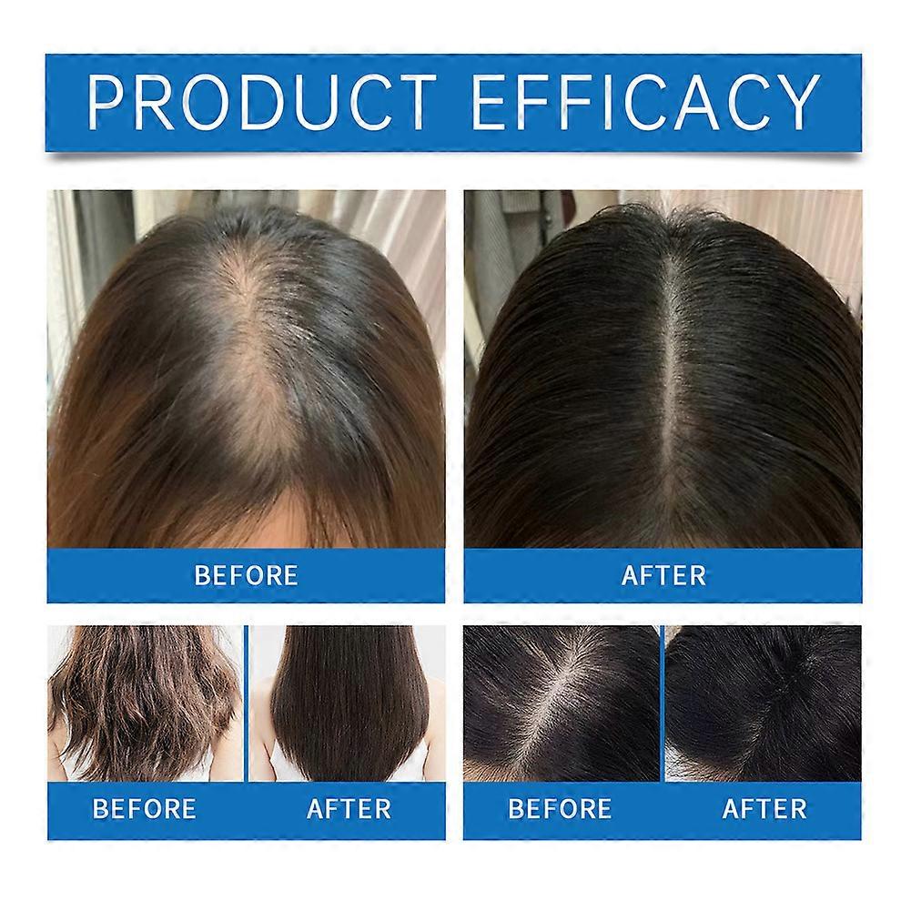 Premium Hair Loss Relief Hair Growth Serum for All Hair Types ...