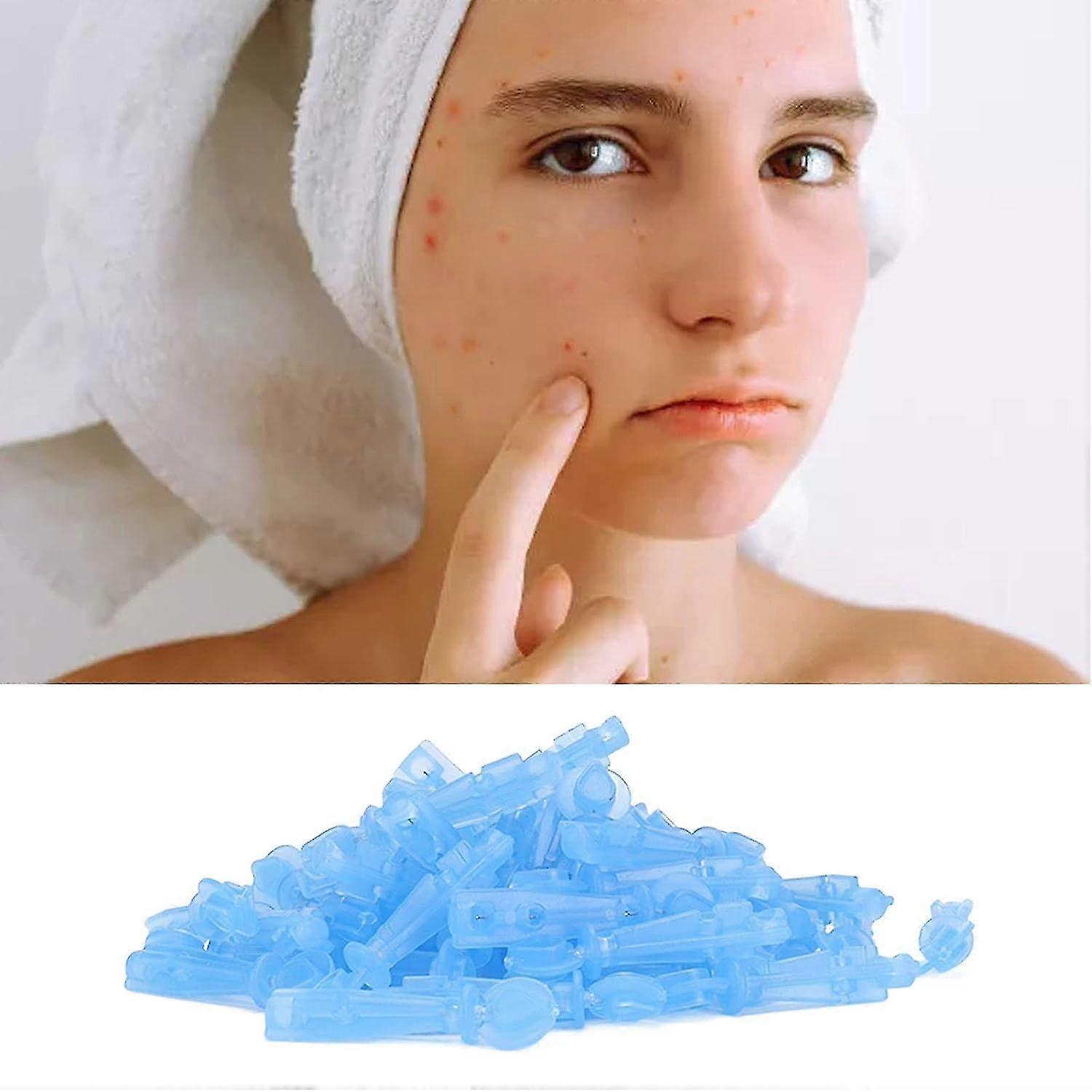 50/100pcs Blackhead Blemish Remover Tool, Professional Disposable Acne ...