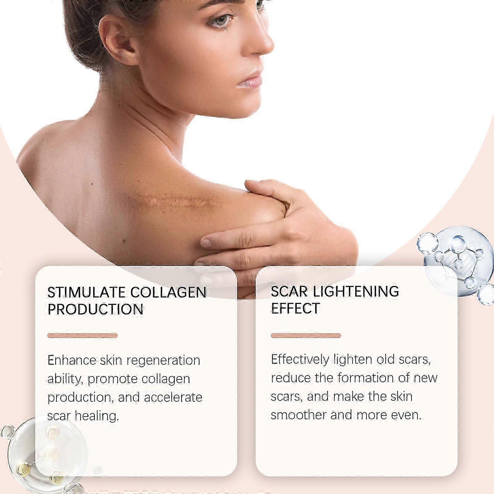 Scar Gel, Advanced Scar Removal Gel, Scar Gel For Surgical Scars ...