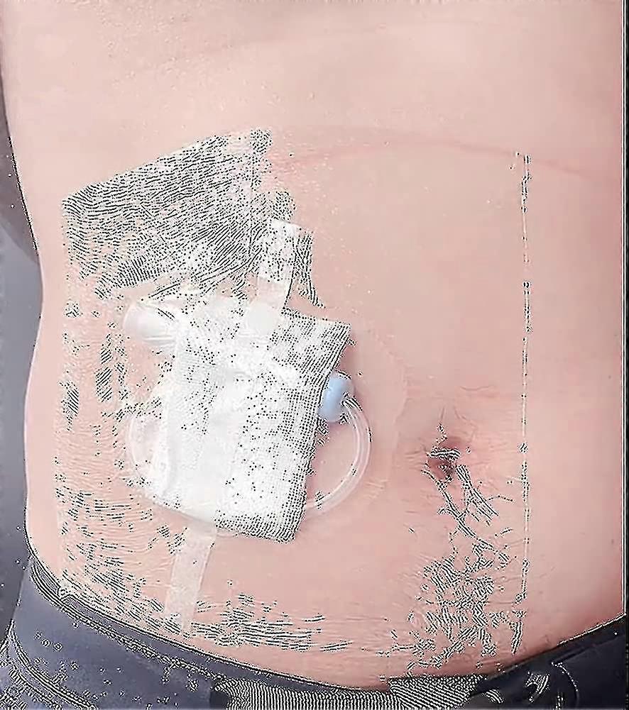 Waterproof Shower Cover Shields For Dialysis Port Picc Line Chest ...