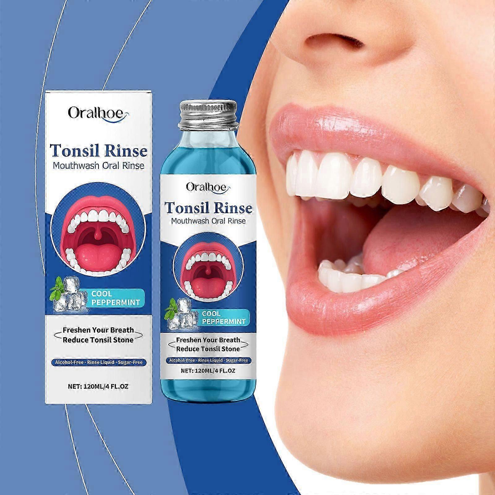 Tonsil Stone Remover, Natural Tonsil Stone Mouthwash, Oral Rinse Liquid ...