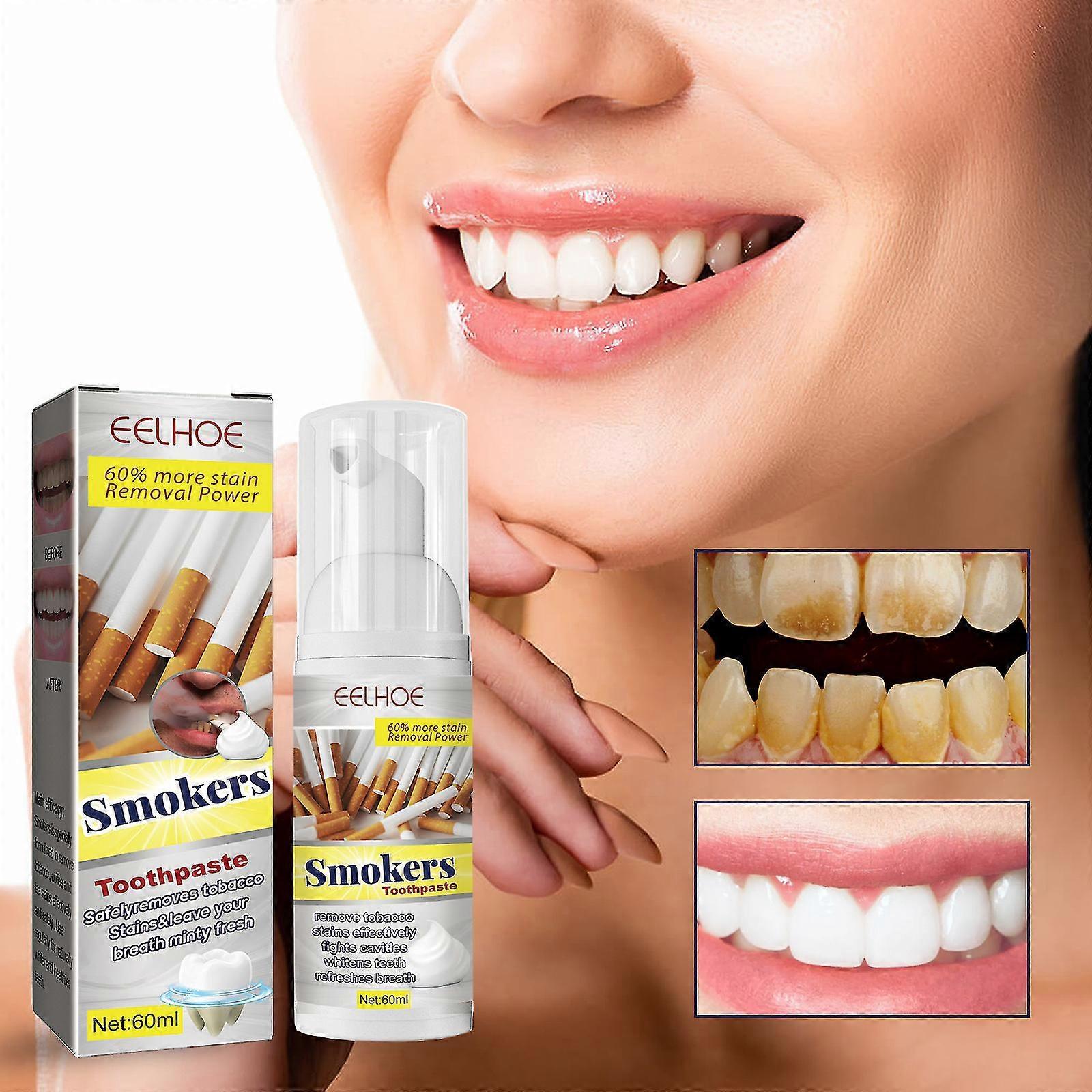 Remove Smoke Stains Toothpaste Smoke Stains Remove Teeth Stains Remove ...