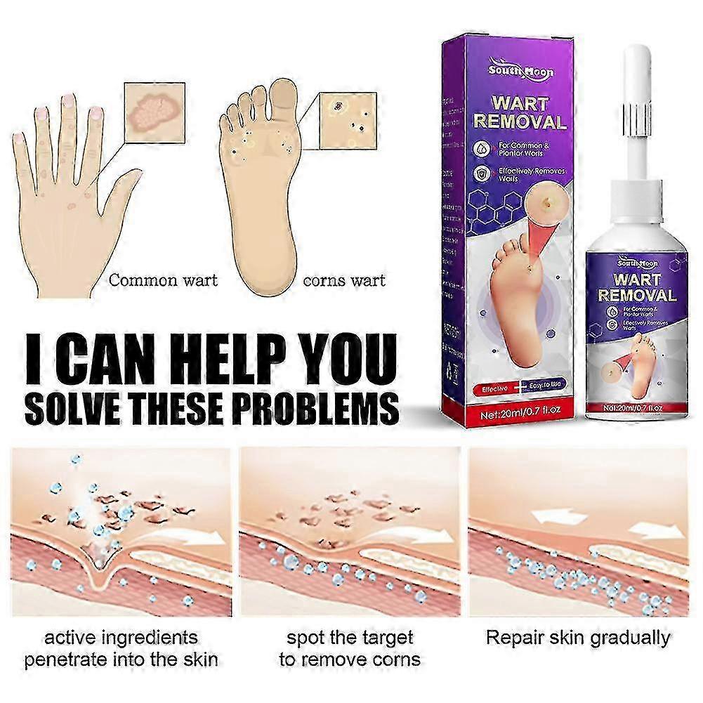 Corn Removal Extra Strengthen Gel Foot Callus Removal Treatment Hard ...