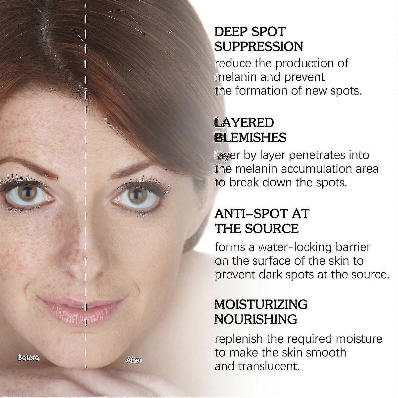Jaysuing Anti-dark Spot Facial Essence Fades Spots And Spots Brightens ...