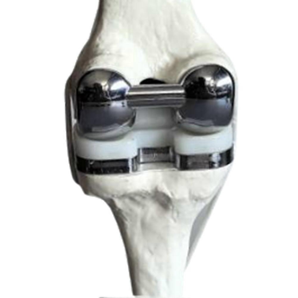 Knee Joint Model Simulation Replacement Surgery Meniscus Ligament ...