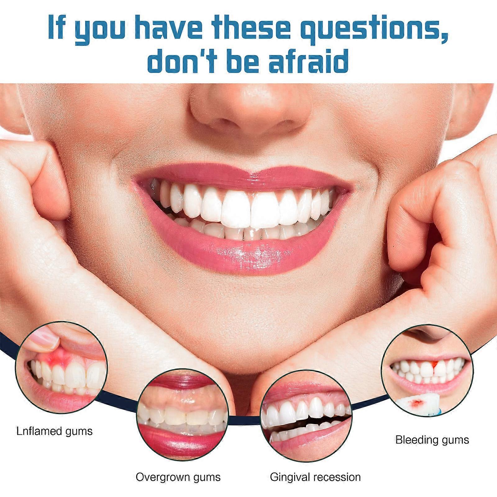 Jaysuing Teeth Care Drops Deep Cleaning Teeth Stains Tartar Swelling ...