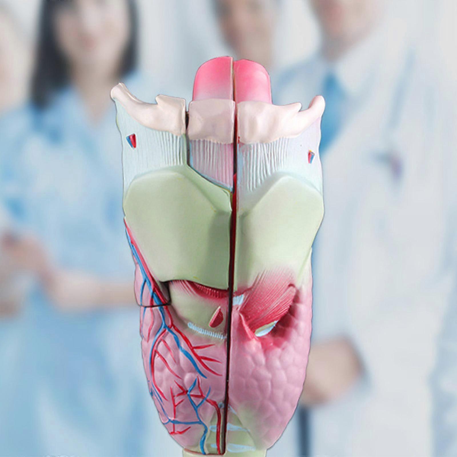 Human Larynx Anatomy Model Enlarged Nasopharynx Laryngopharyngeal Model ...