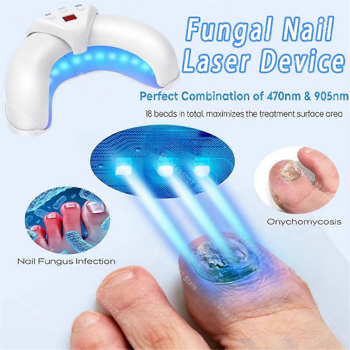 Nail Laser Treatment Device Remove Onychomycosis Grow Toe Nail | Fruugo UK