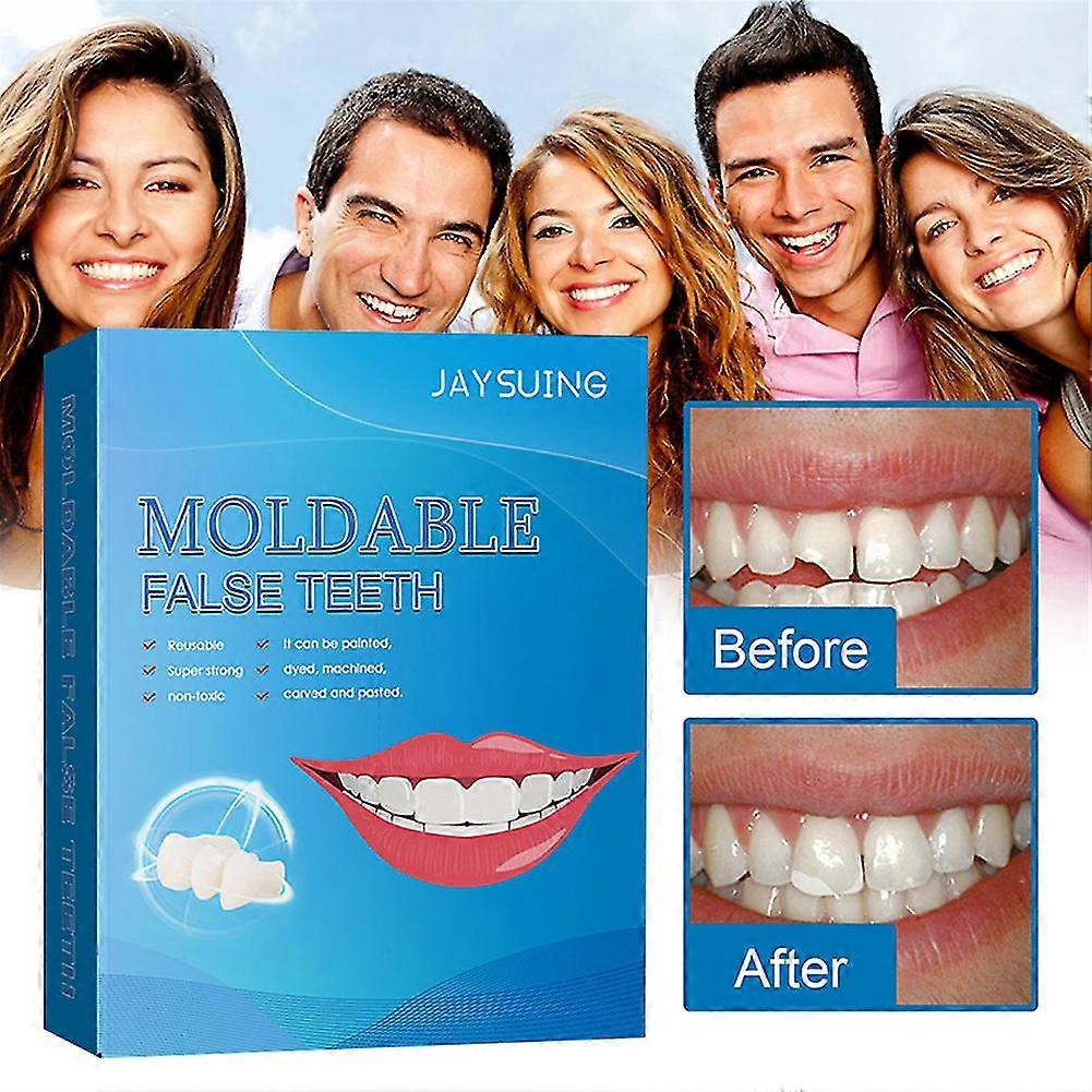Moldable Tooth Filling False Teeth Temporary Repair Kit Solid Glue ...