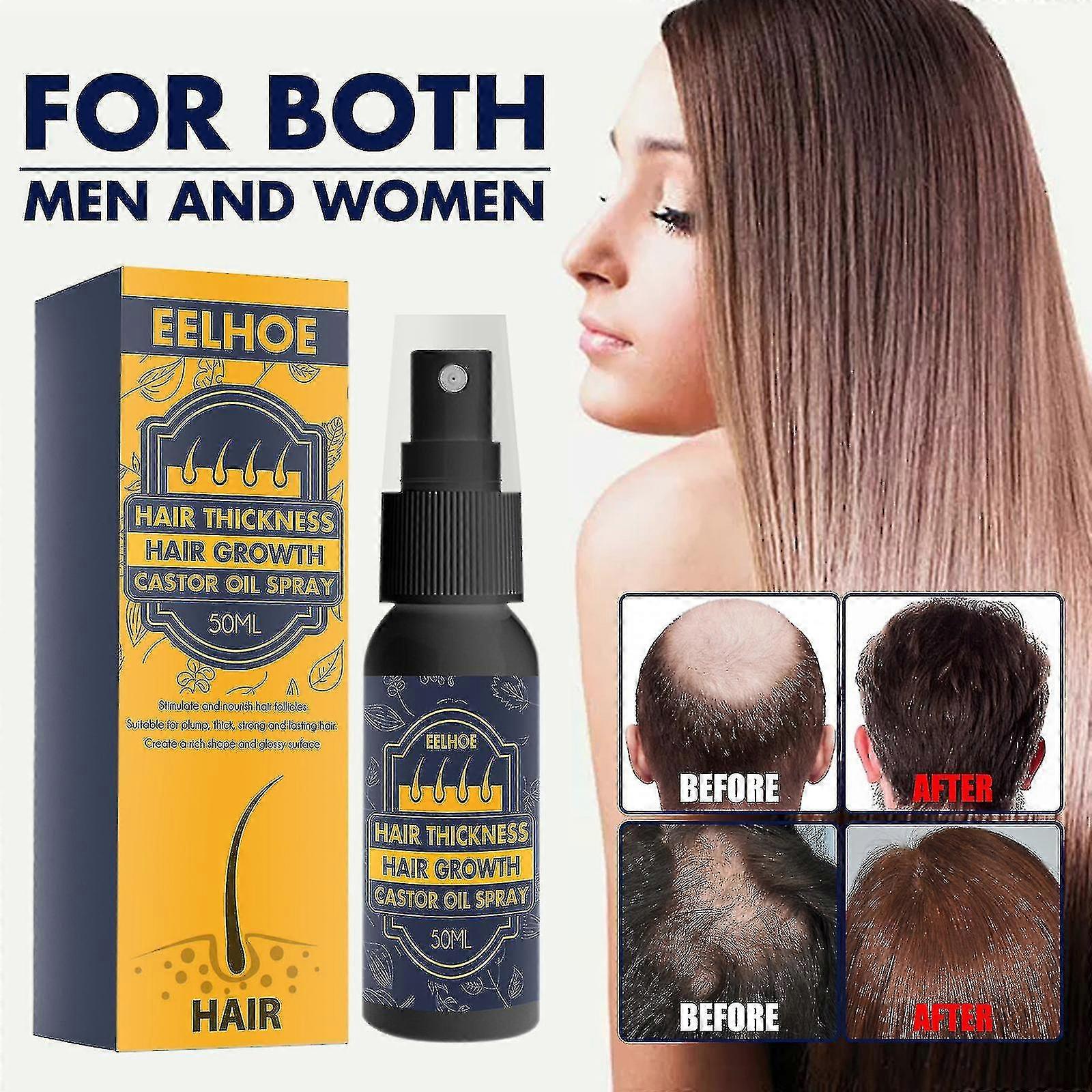 Leke Moisturizing Hair Follicle Castor Oil Hair Growth Hair ...