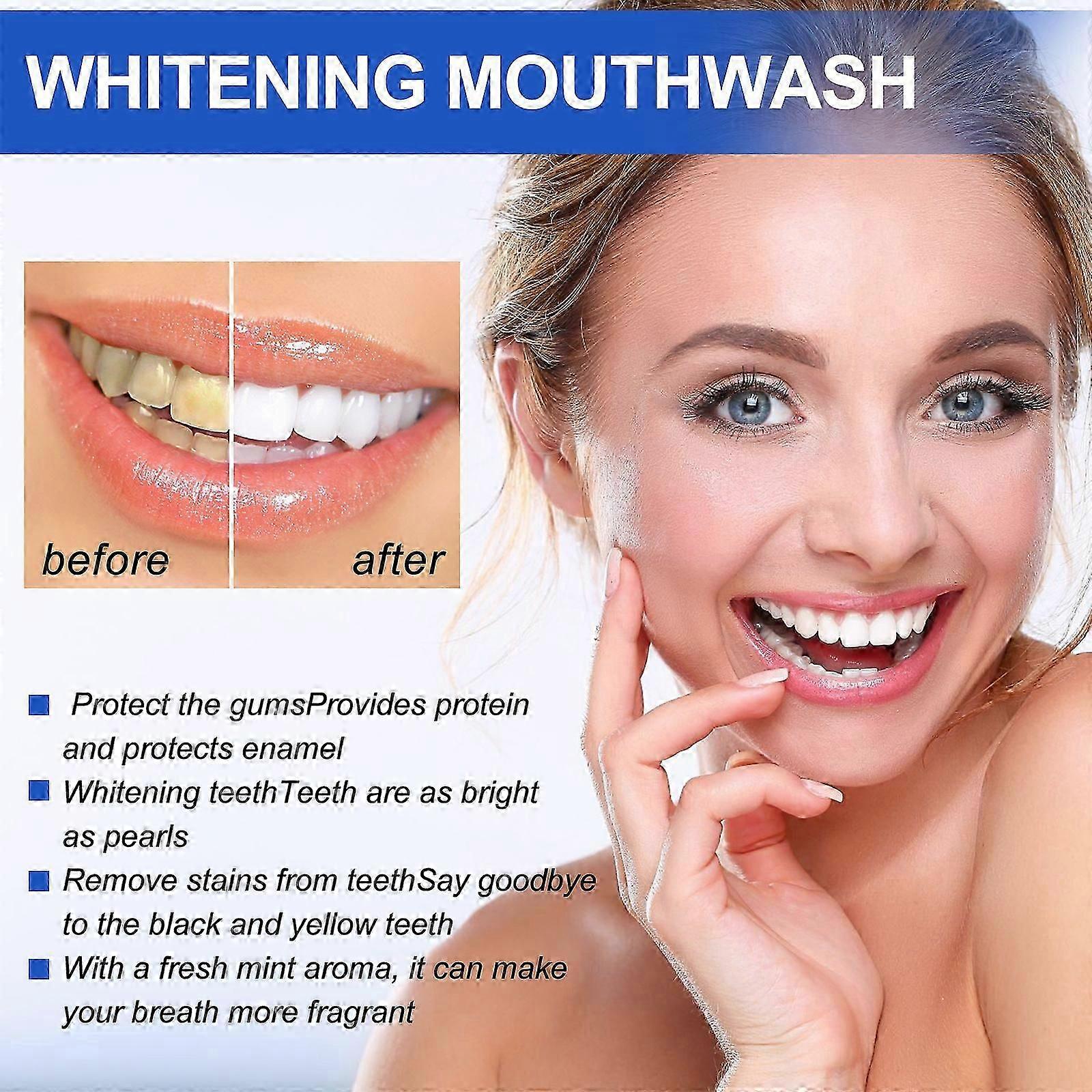 Teeth Cleaning For Fresh Breath - Eelhoe Whitening Care | Fruugo UK
