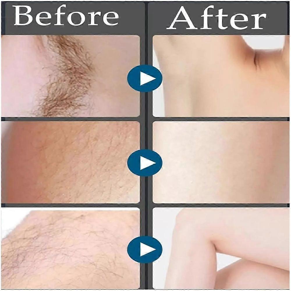 Glowtrim 4-in-1 Precision Grooming Trimmer,Rechargeable Sideburn ...