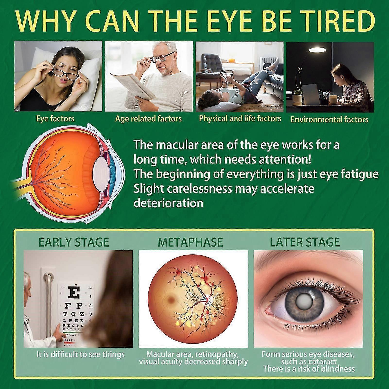 Eye Protection Ointment Anti- Bacteria Cleaning Eyesight Care Cream for ...