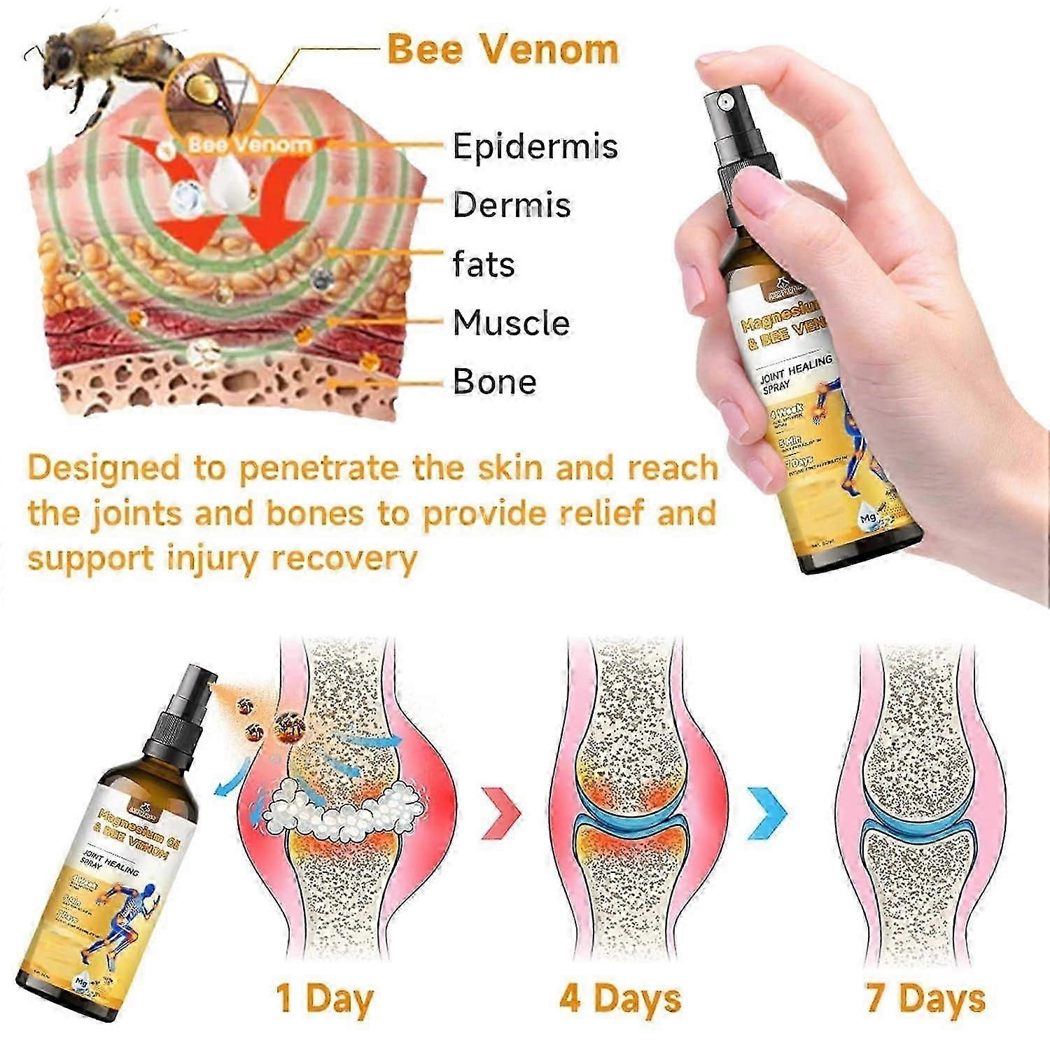 Bee Venom Spray, Bee Venom Joint & Bone Care Spray, Magnesium Oil Bee Venom Joint Relief Spray ...