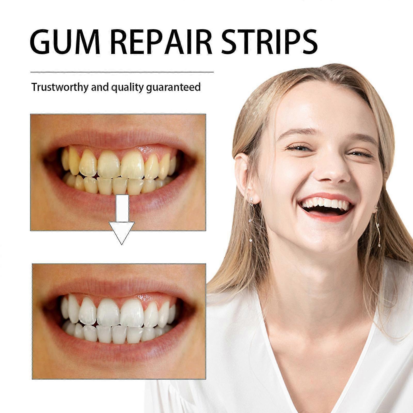Jaysuing Teeth Strips Deep Cleaning Teeth Stain Teeth Yellow Tartar ...