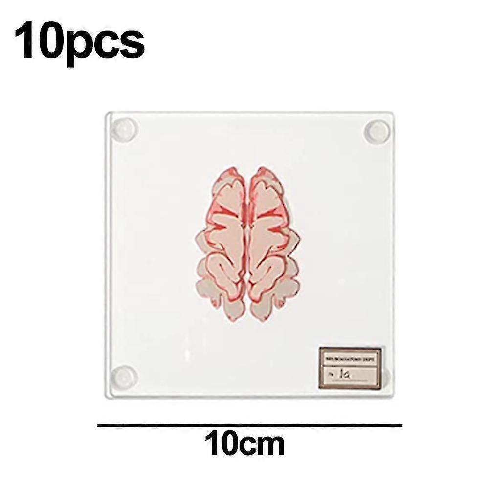 Anatomic Brain Specimen Coasters-gifts For Medical Student Gifts Brain ...