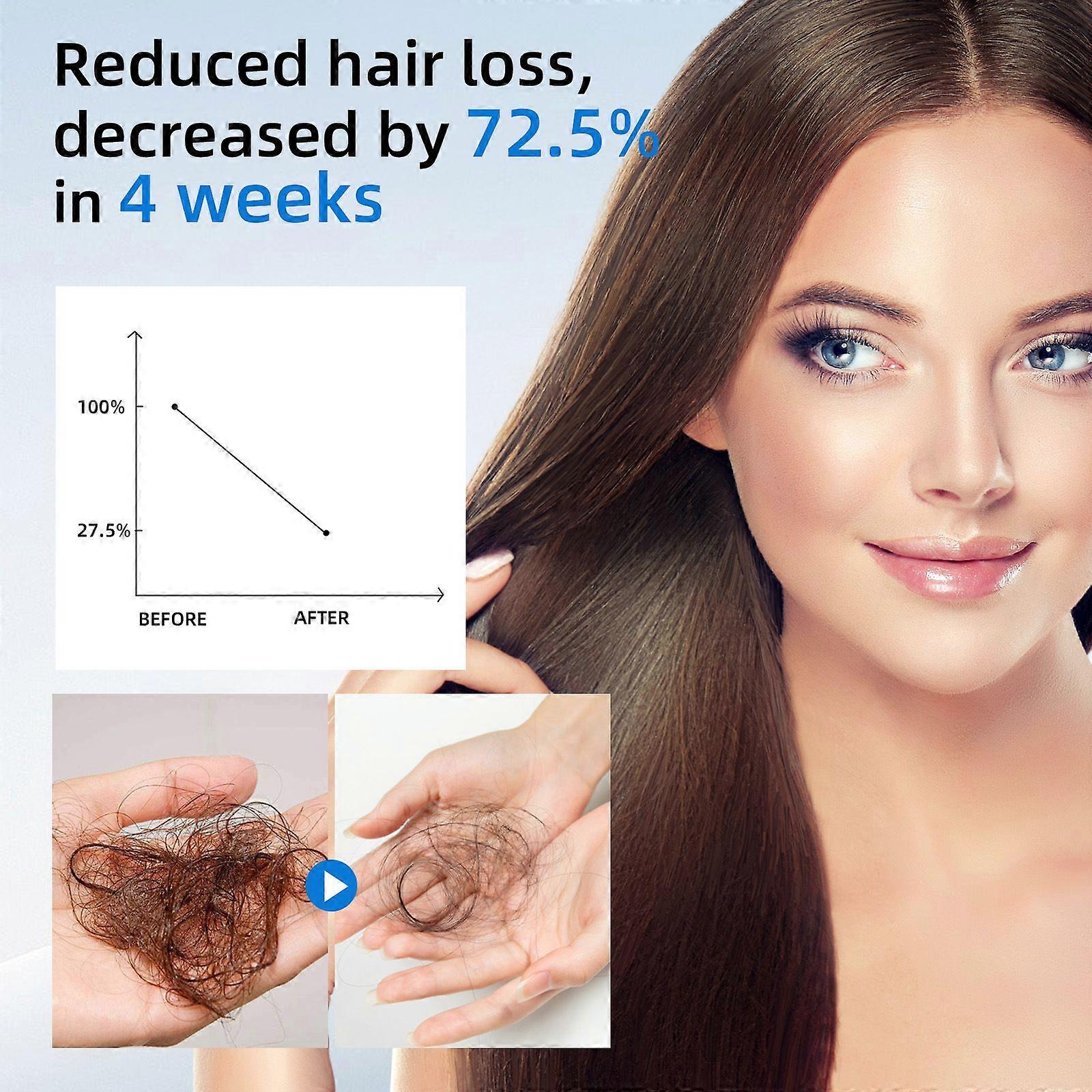 Scalp Treatment | Scalpy Hair Growth Serum for Hair Loss & Thinning ...