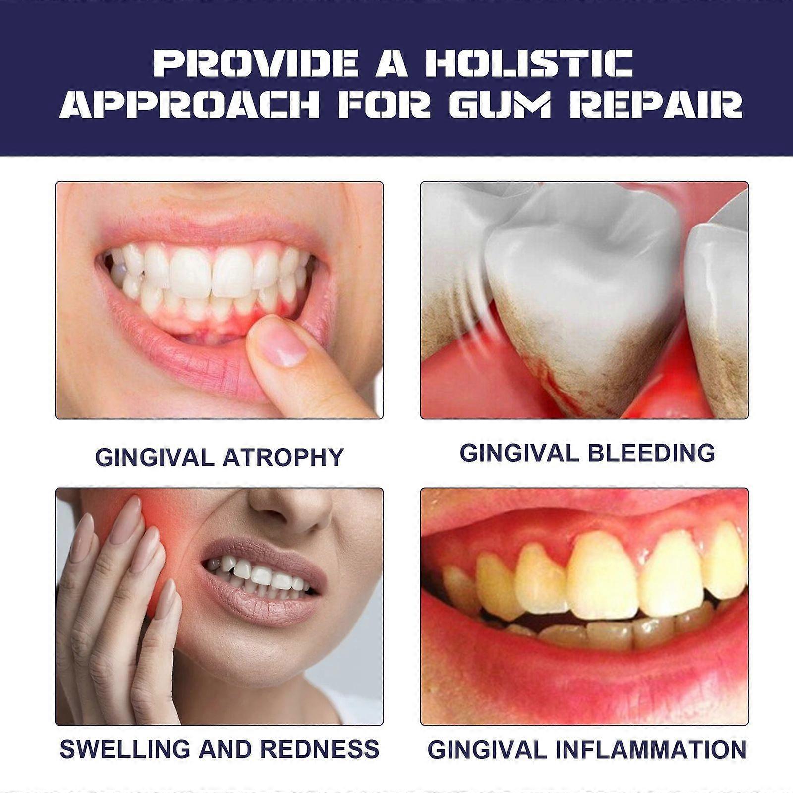 Teeth Repair Gel, Oral Repair Gel, Healthy Gums, Breath Freshener ...