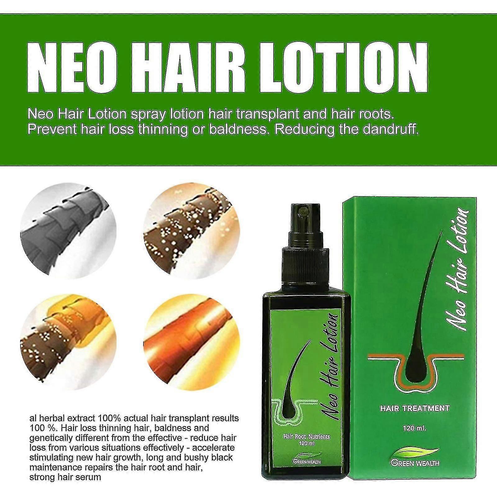 120ml Thailand Neo Hair Lotion Serum Essence Anti Hair Loss Treatment Hair Beard Growth For Men ...