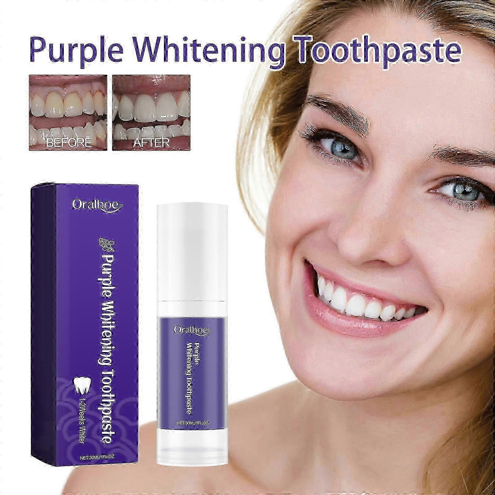 Oralhoe purple whitening toothpaste, fresh mouth, whiten teeth, remove ...
