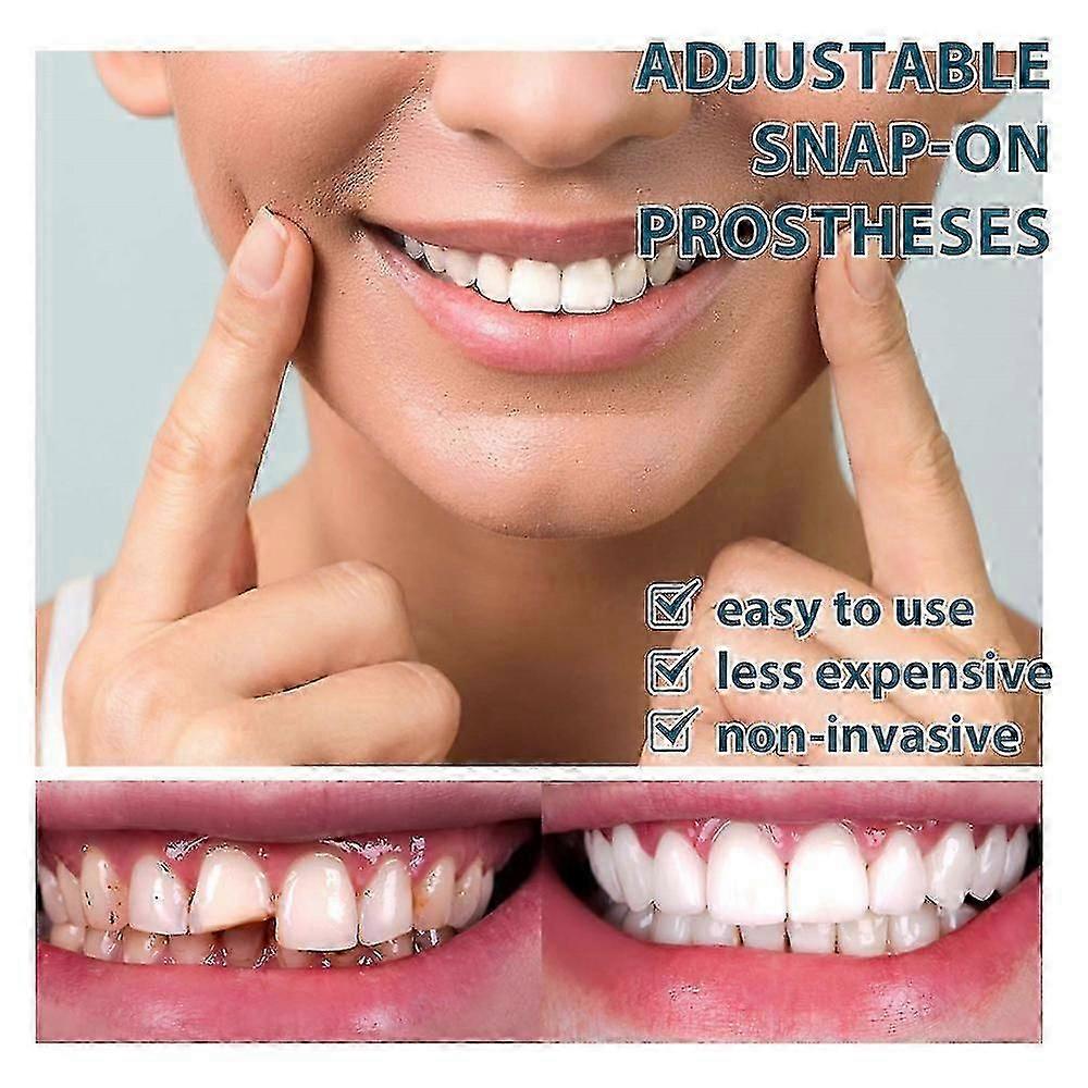 2X Adjustable Snap-on Dentures, Veneers Denture Braces Plus Denture ...