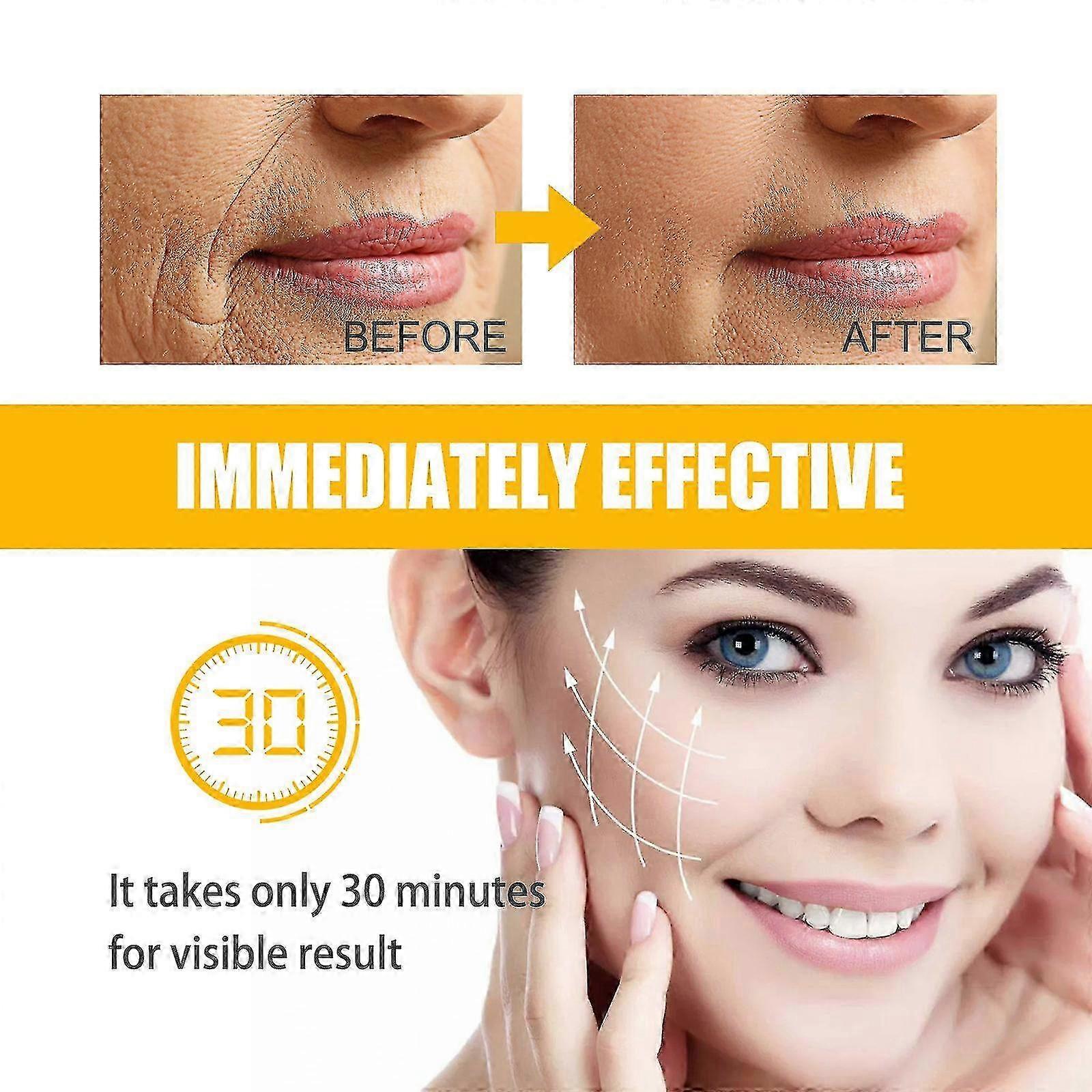 Jaysuing Collagen Smile Line Patch Lifts Facial Smile Lines Anti ...