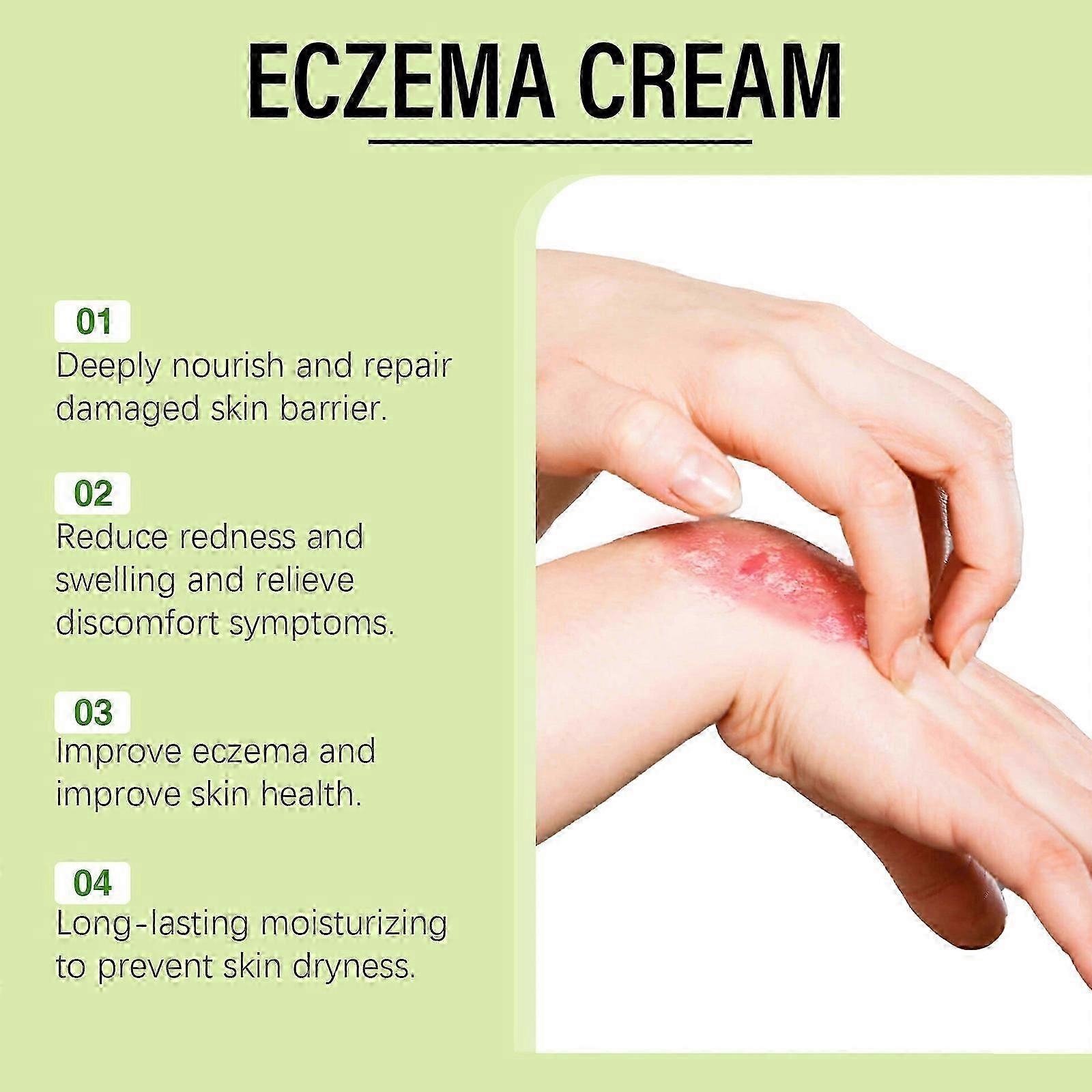 Herbal Eczema Ointment, Eczema Cream, Herbal Psoriasis Cream, Anti-inflammatory and Bactericidal ...