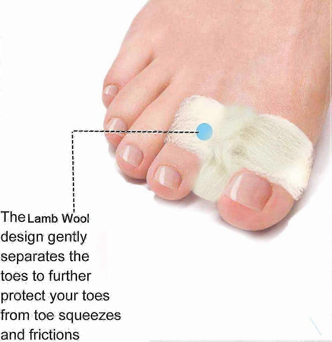 4 Bags Lambs Wool Toe Splint Cushions for Toes, Soft Feet Lams Wool Toe ...